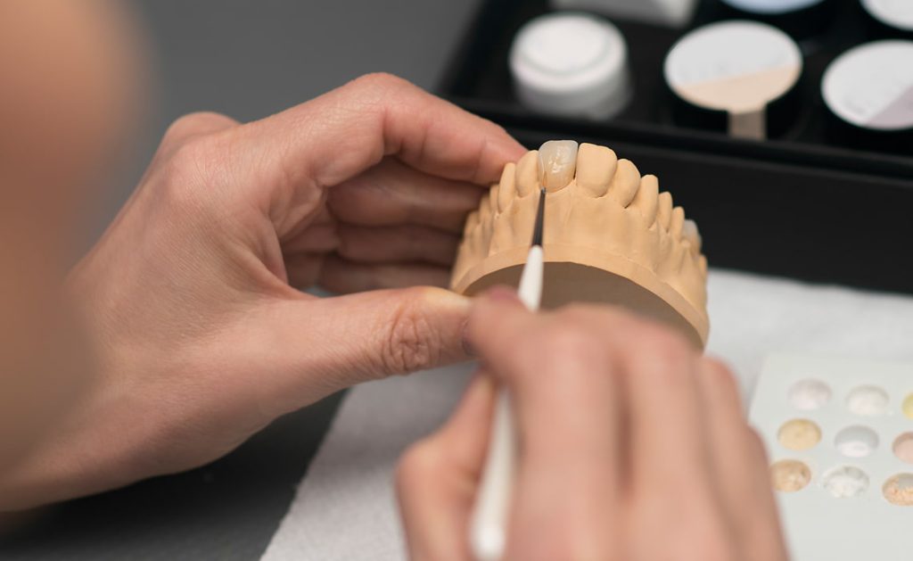 Zubna protetika i sve što trebate znati - Novodent Tuzla